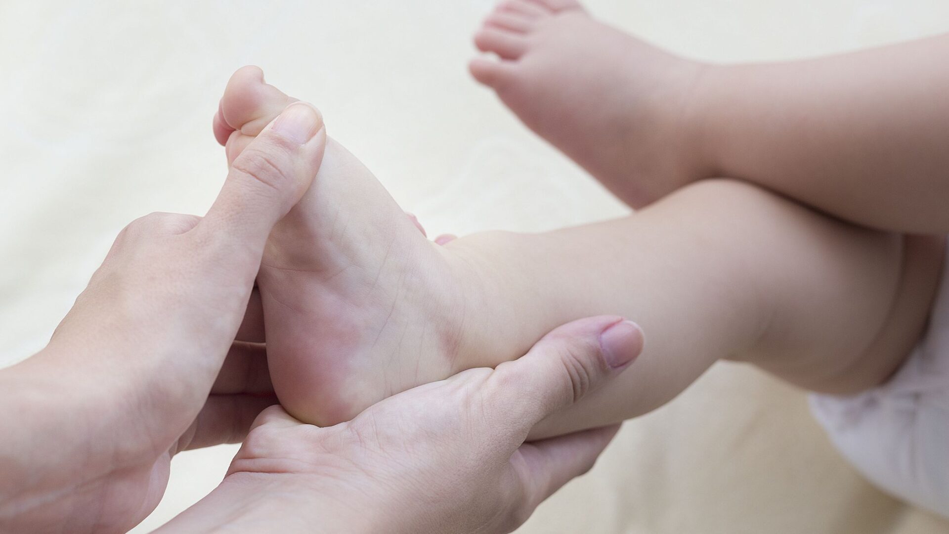 3 Non-Surgical Treatments for Talipes - Cii Central